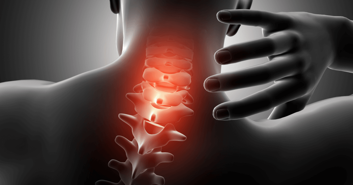 What Are the Permanent Restrictions After ACDF Surgery?